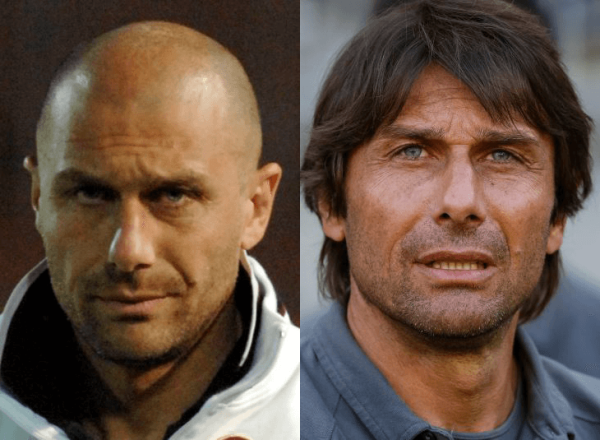 Antonio Conte, trapianto capelli, parrucchino o patch cutanea? » Newlacecu